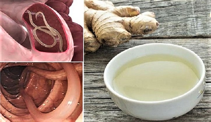 Estes são os sinais que seu corpo está com vermes, veja como eliminar o ...