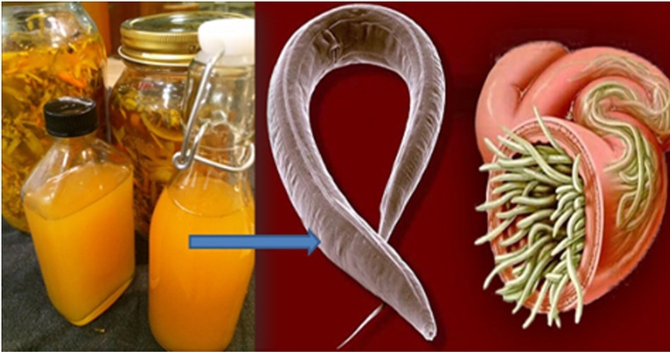 Elimine qualquer tipo de parasita do seu corpo com remédio caseiro ...